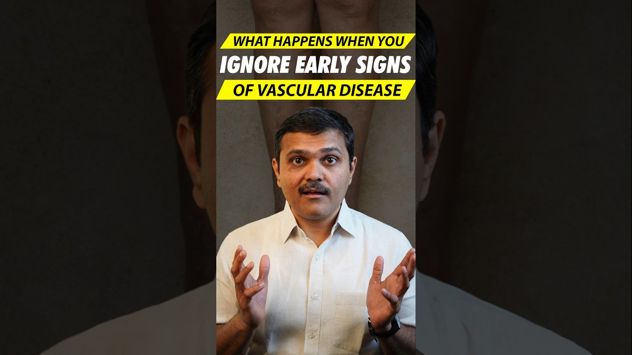 AV Fistula Complications: Managing Challenges and Risks