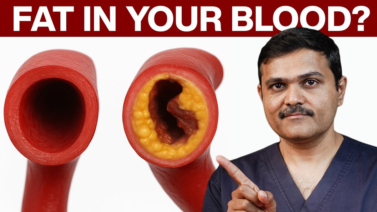 A Comprehensive Guide to Understanding Dialysis Fistulas