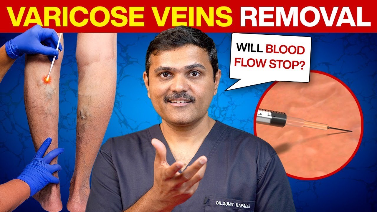 A Comprehensive Guide to Understanding Dialysis Fistulas