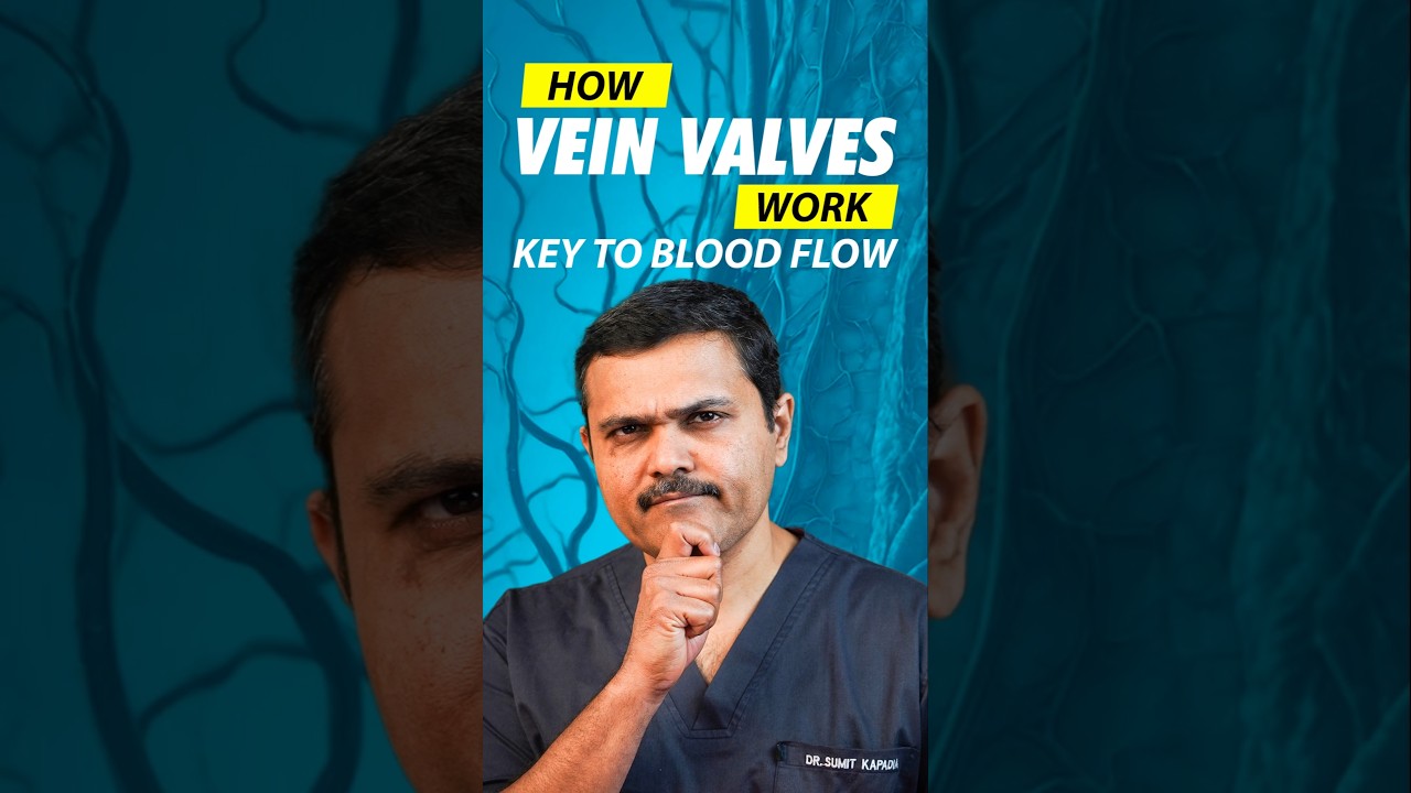 Deep Vein Thrombosis vs. Varicose Veins: A Complete Guide